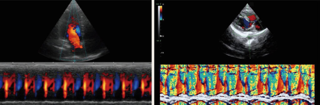 Advanced Design Full Digital Color Doppler Ultrasound System - Narula ...