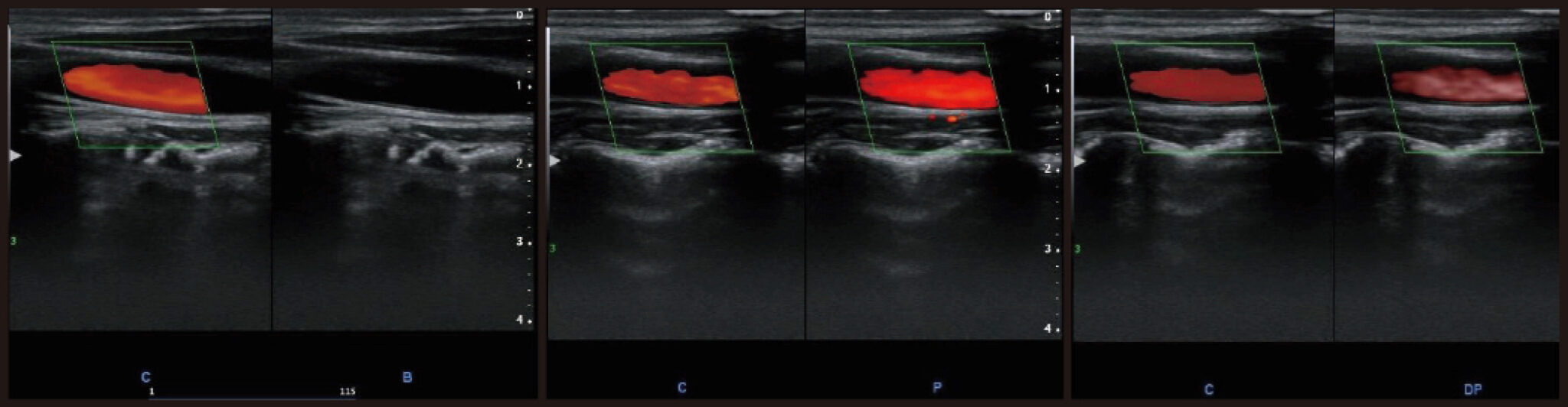 Advanced Design Full Digital Color Doppler Ultrasound System - Narula ...
