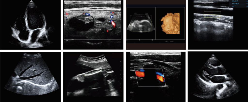 Advanced Design Full Digital Color Doppler Ultrasound System - Narula ...
